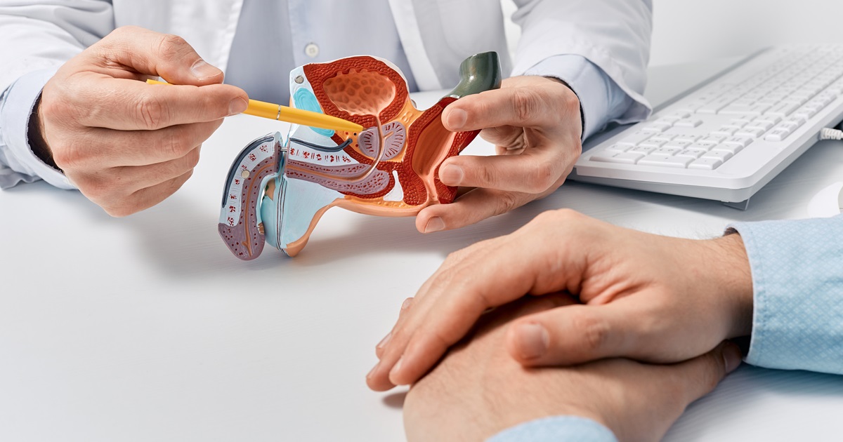 What is Prostate Artery Embolization (PAE)?