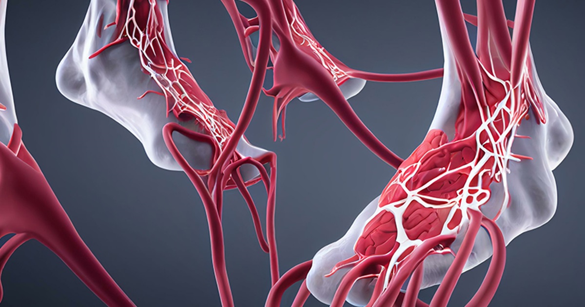 Peripheral Arterial Disease: Symptoms, Causes and Treatment